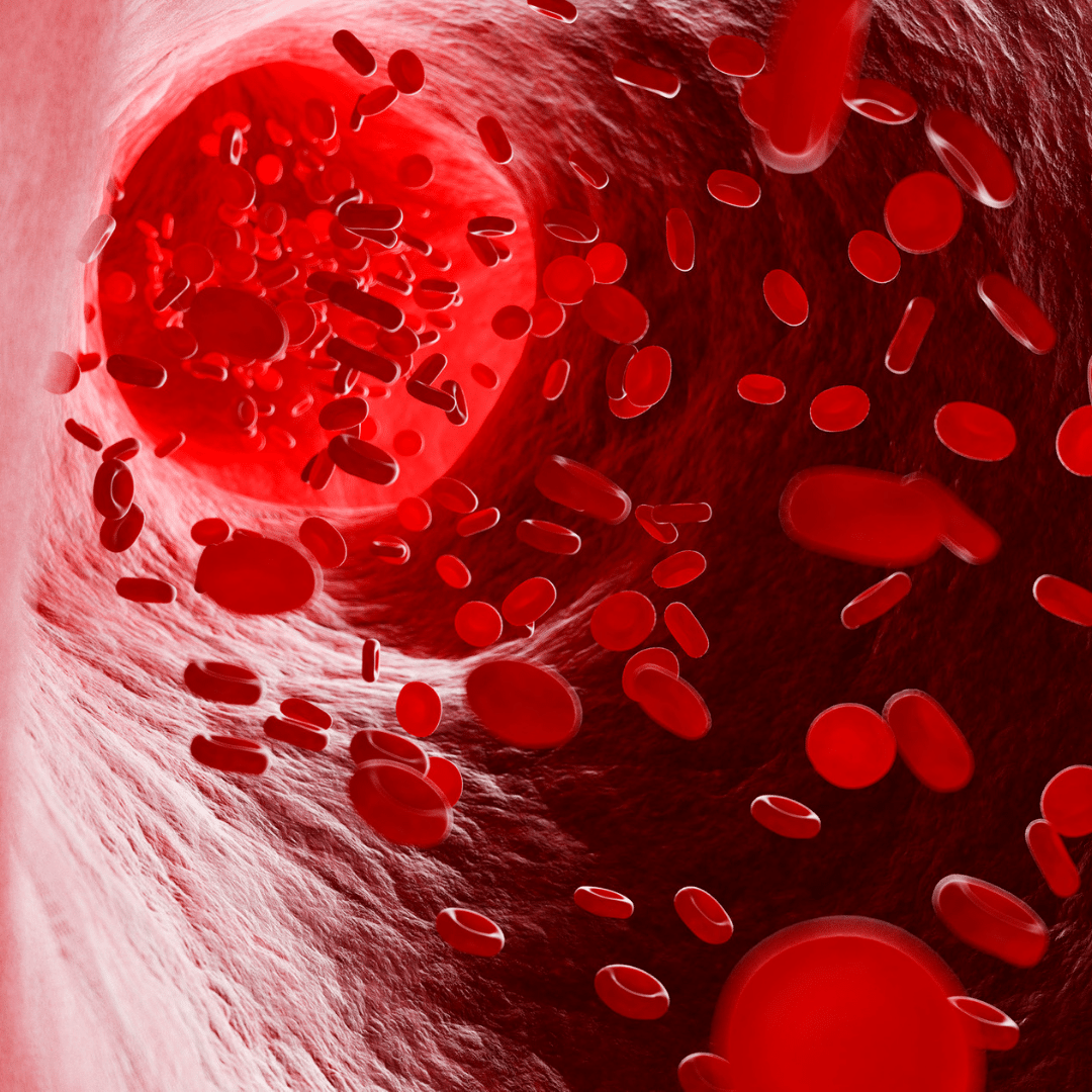 Exercise and Anemia: Setting the Stage for Success - MBSF